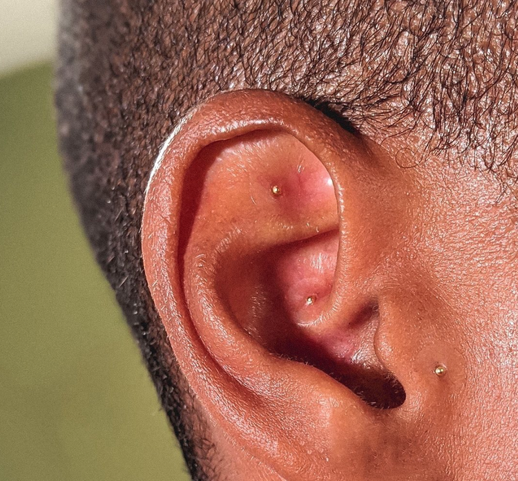 Ear Seeds — The Way of Yin