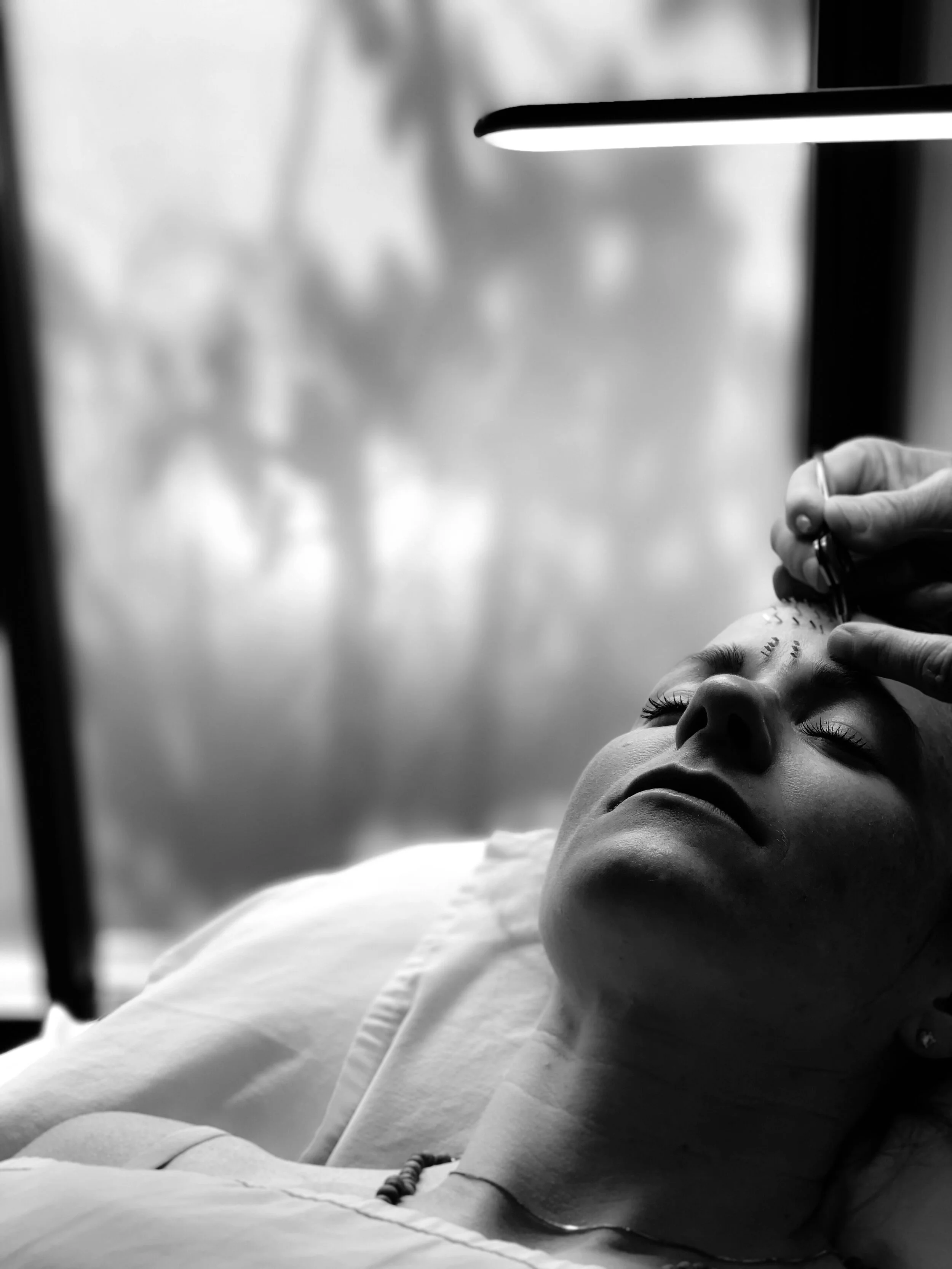 Acupuncture & TCM Vancouver & Burnaby | Near Me | Chinese Medicine | Qi ...