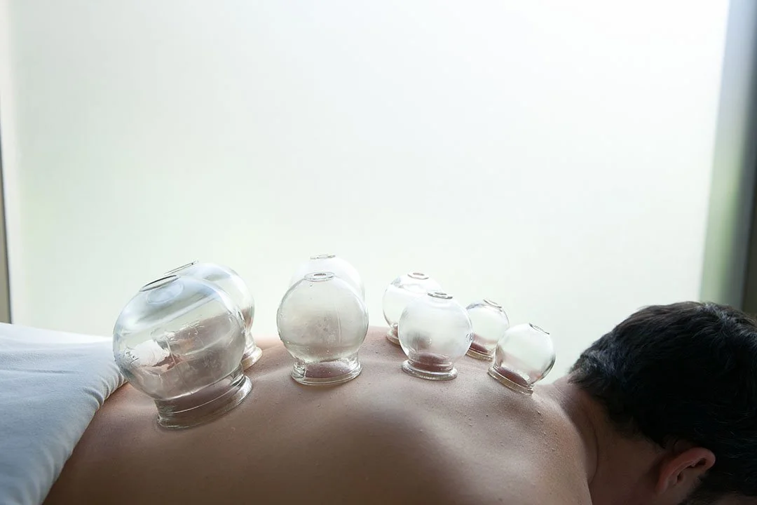 How Cupping Therapy Supports Athletic Performance | Qi Integrated Health