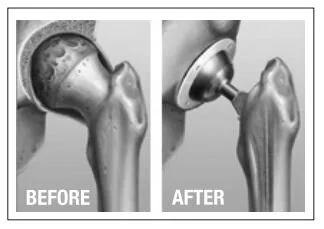 Preoperative — SMH Orthopaedics