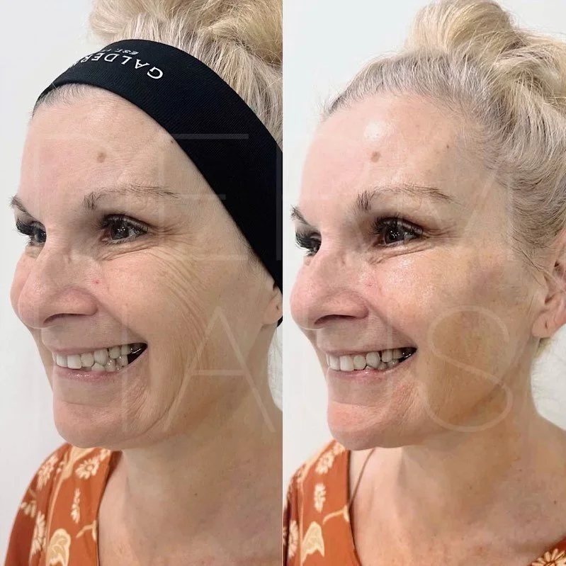 Derm Haus | Brisbane's Top Rated Medical Aesthetics & Skin Clinic