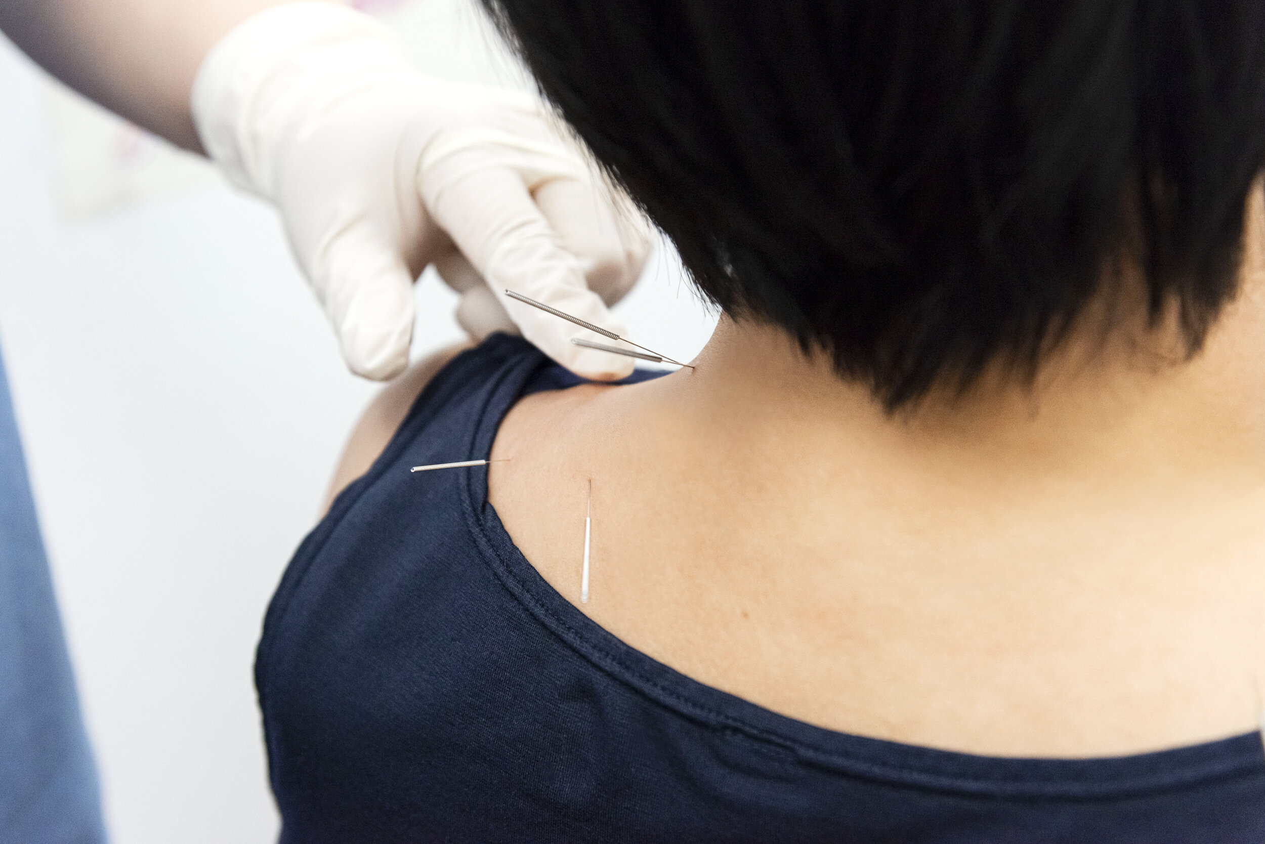 Rising Lotus Acupuncture