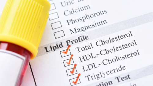 Dietitian’s Tips to Raise Your HDL (aka “good” cholesterol) — Dietitian ...