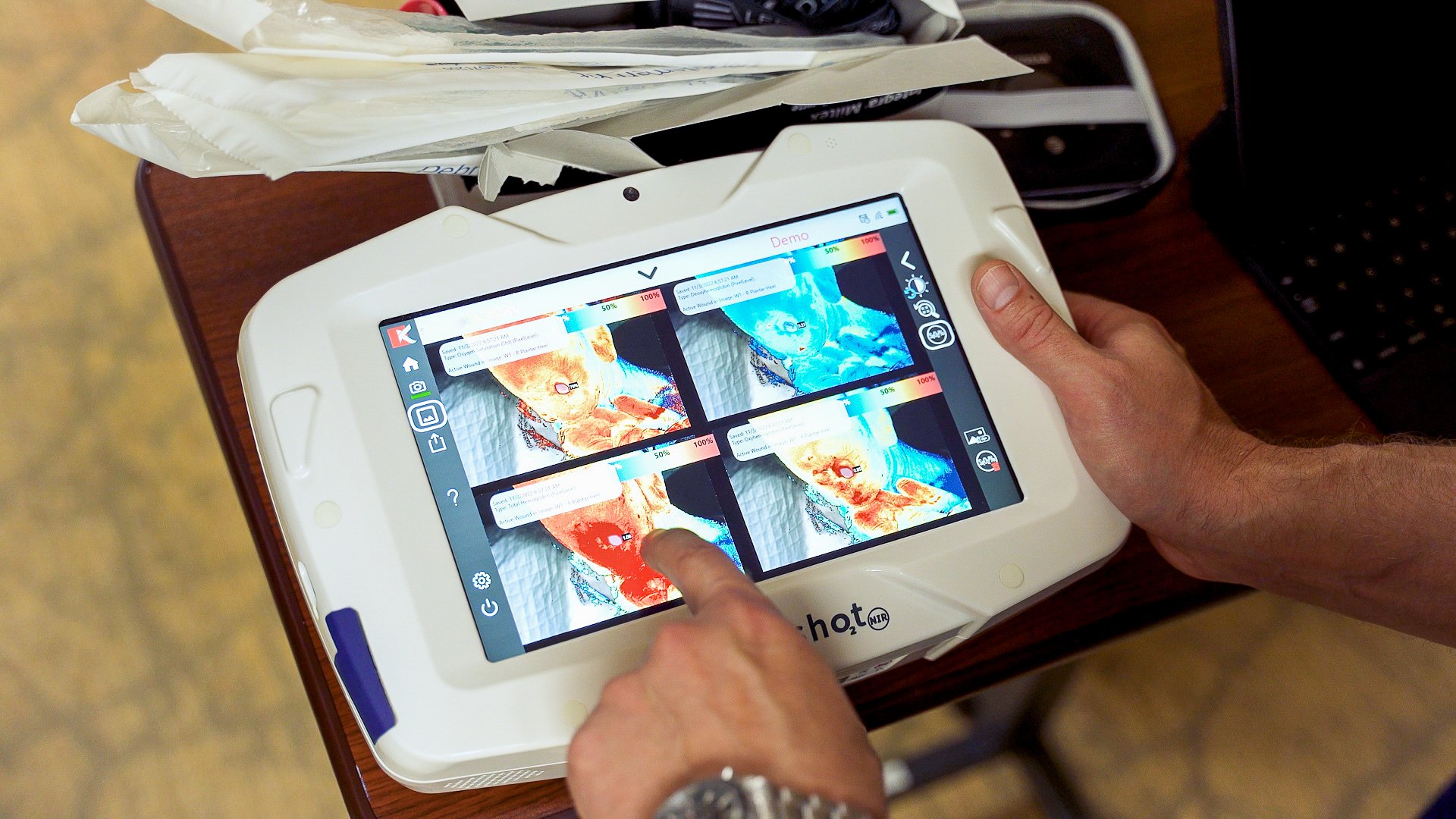 Meet Our CMO of Wound Care — Kent Imaging