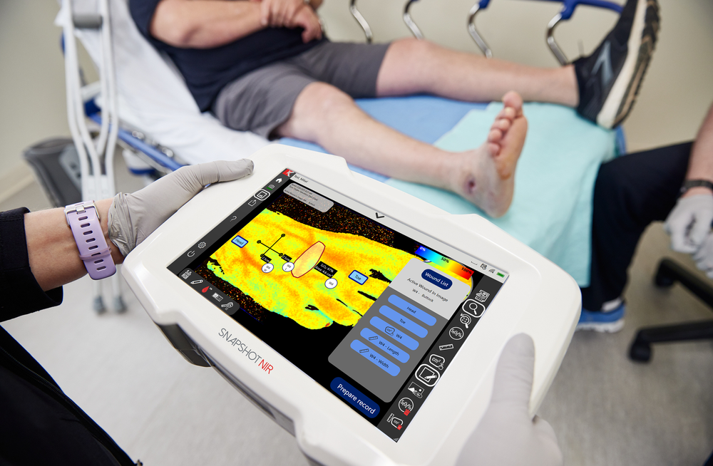 SnapshotNIR Product Update: New Reports and EHR Compatibility — Kent ...