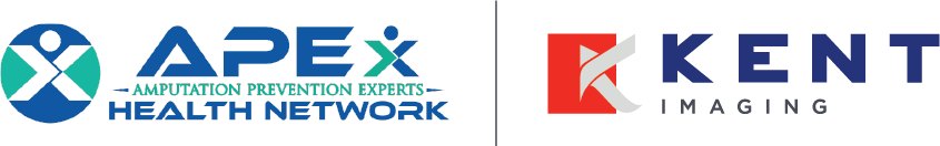 Kent imaging and APEX partner to provide limb preservation solutions ...
