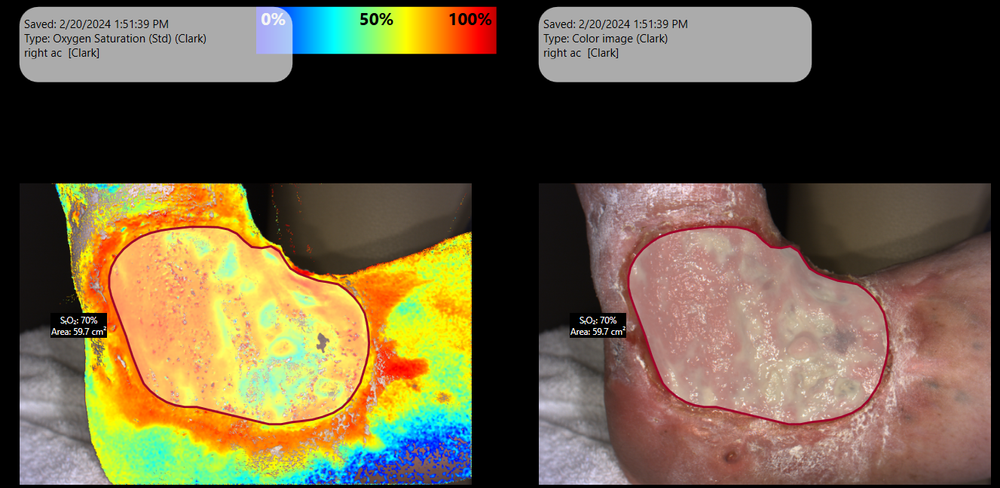 Measurement and Documentation in Wound Care — Kent Imaging