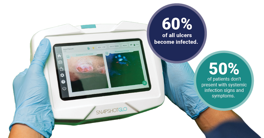 SnapshotGLO, a bacterial autofluorescence medical imaging device — Kent ...