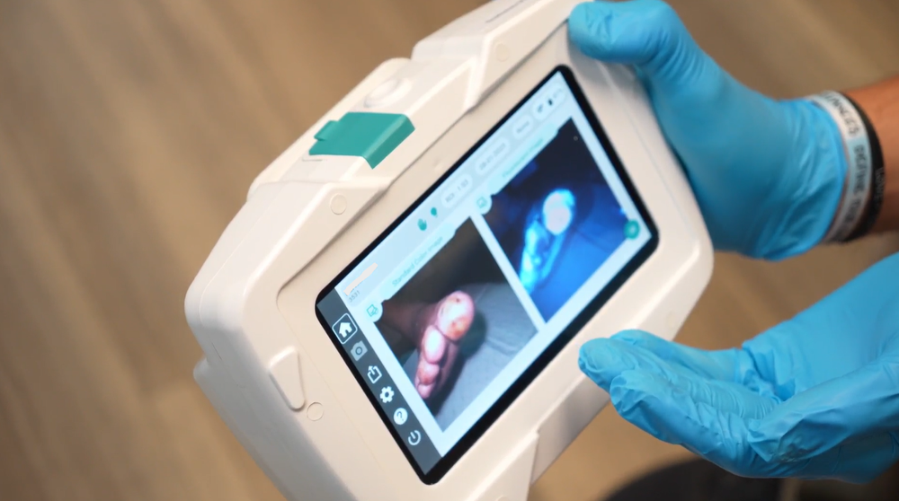 SnapshotGLO, a bacterial autofluorescence medical imaging device — Kent ...