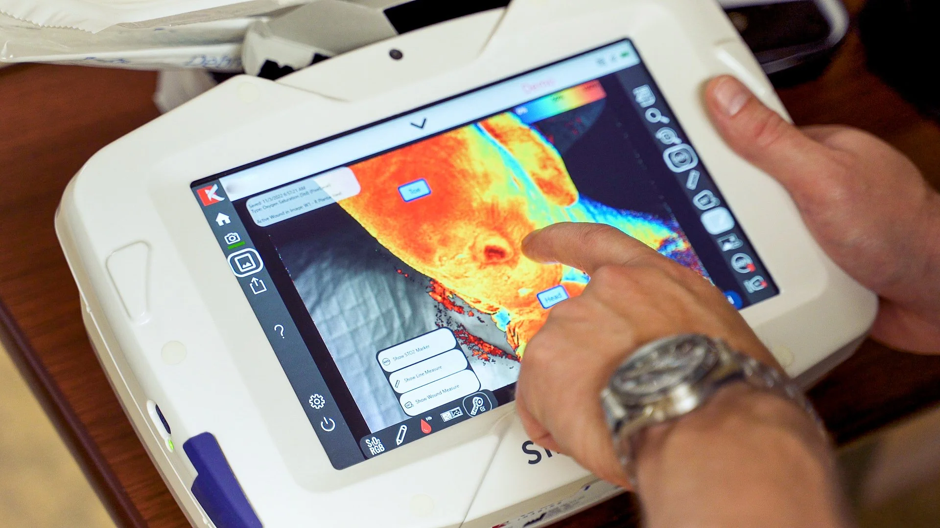 News — Kent Imaging