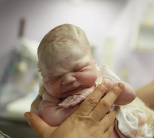 Vernix Caseosa: What Is It And How Can It Benefit Your Baby — Pediatric ...
