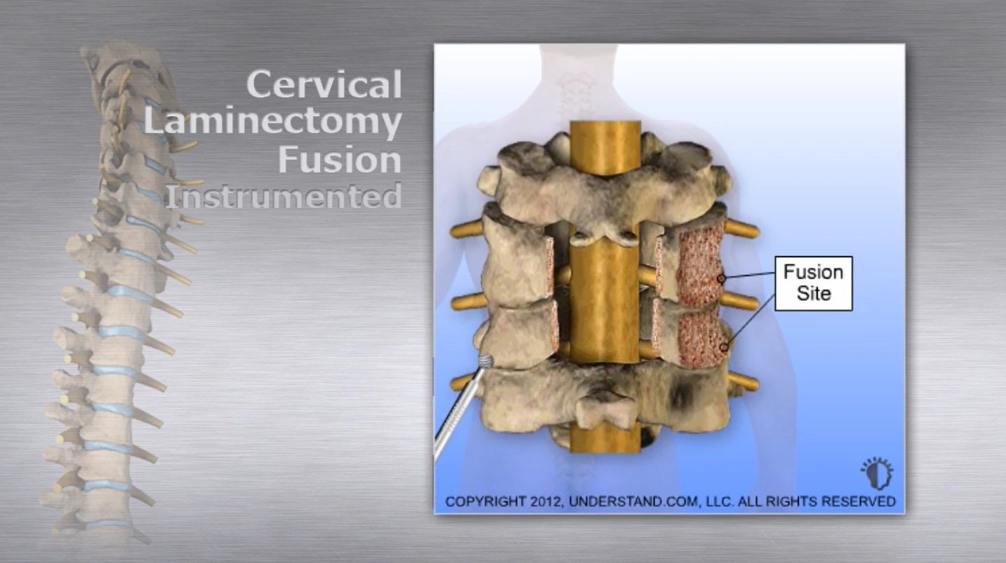 Informational Videos — reVive Spine Center