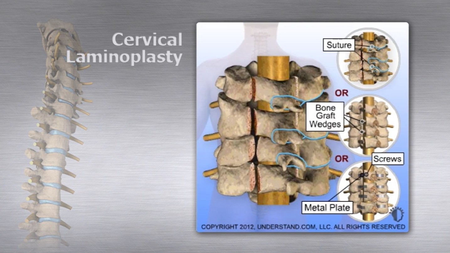 Informational Videos — reVive Spine Center