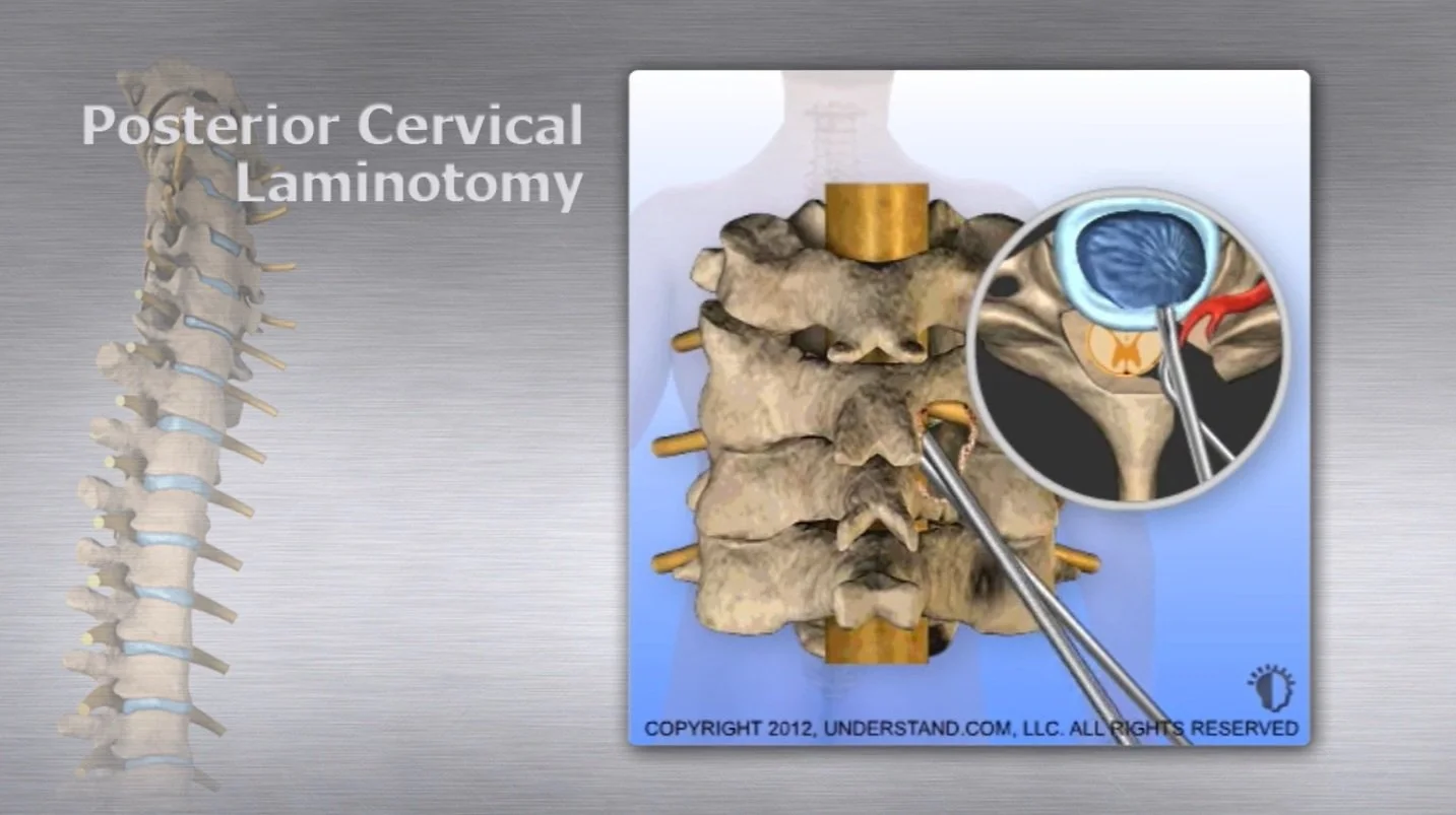 Informational Videos — reVive Spine Center