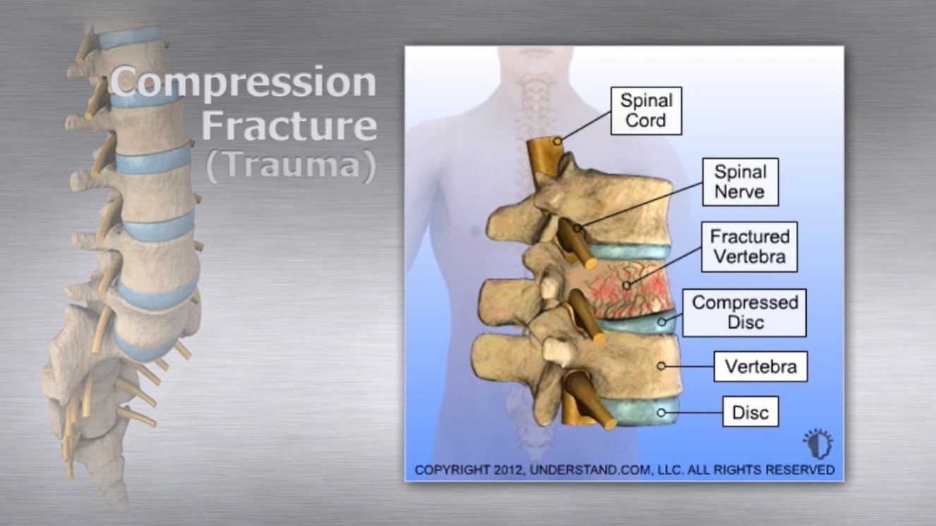 Informational Videos — reVive Spine Center