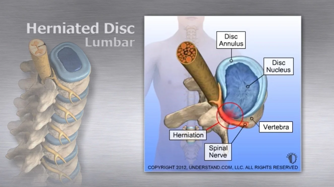 Informational Videos — reVive Spine Center