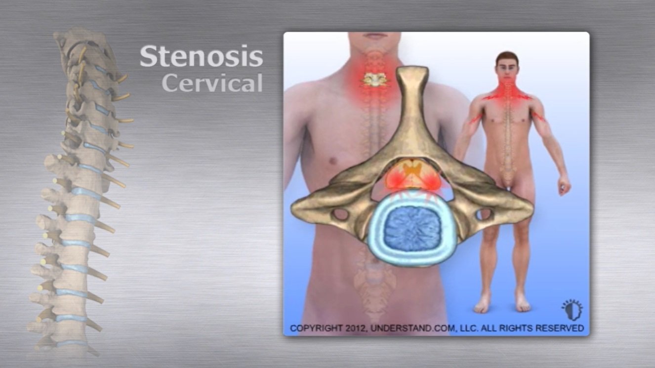 Informational Videos — reVive Spine Center