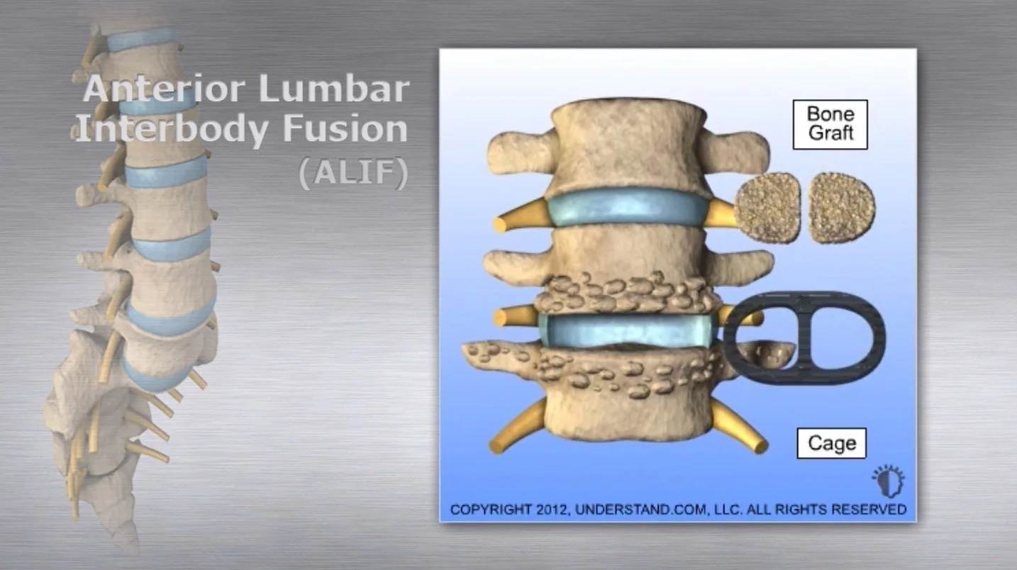 Informational Videos — reVive Spine Center