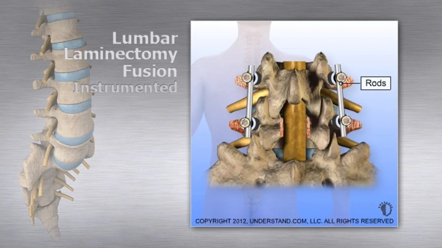 Informational Videos — reVive Spine Center