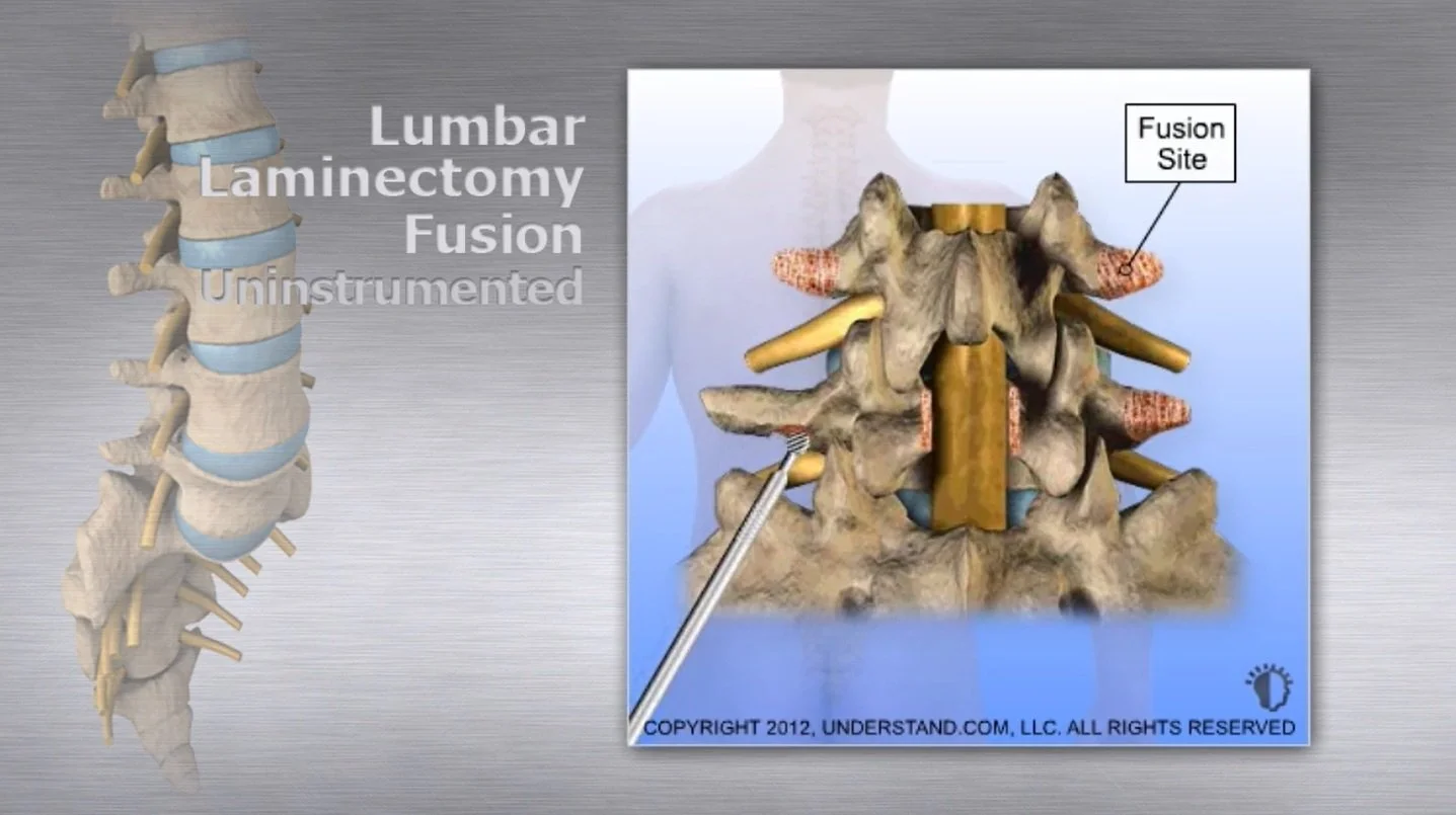 Informational Videos — reVive Spine Center