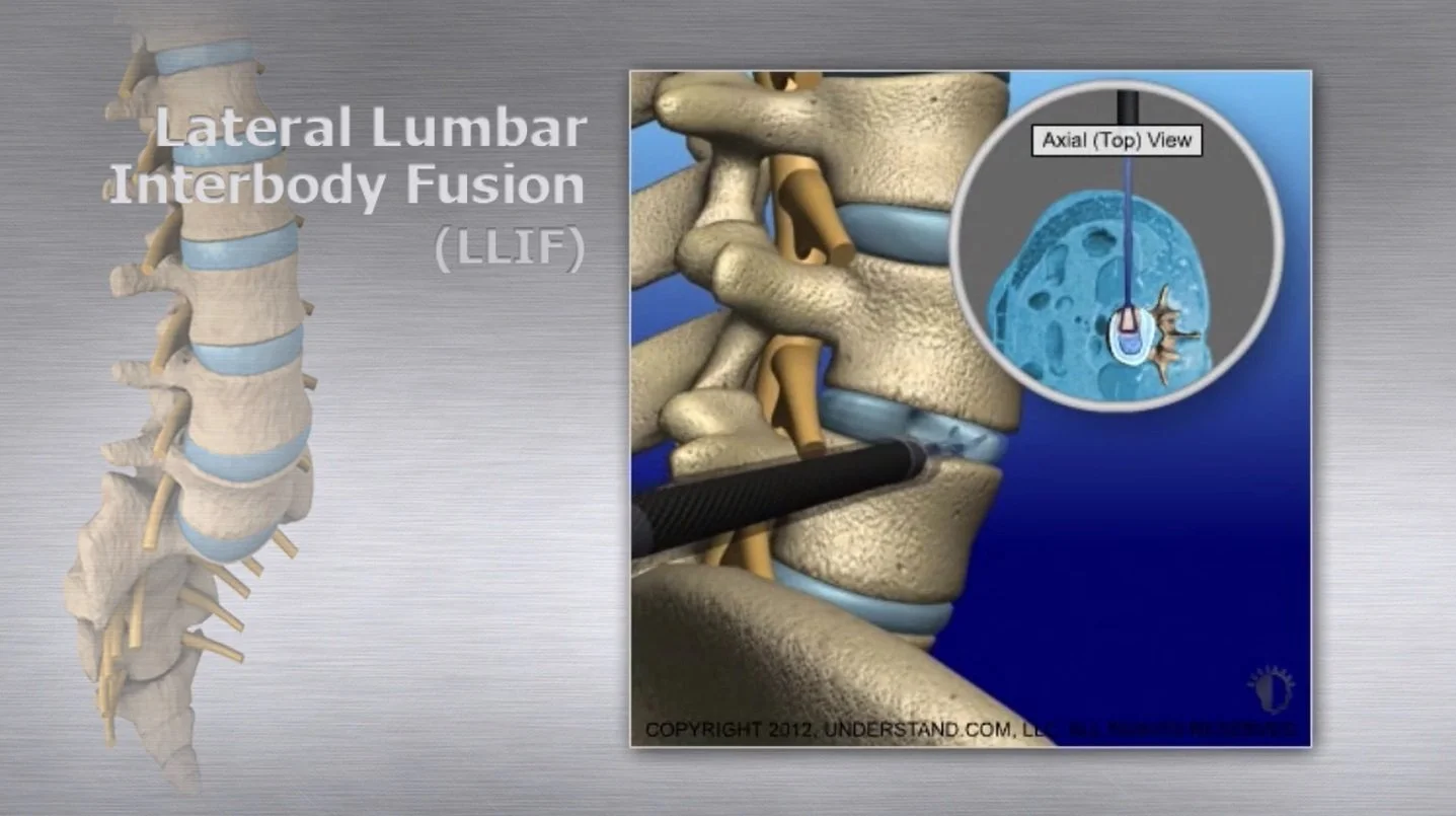 Informational Videos — reVive Spine Center