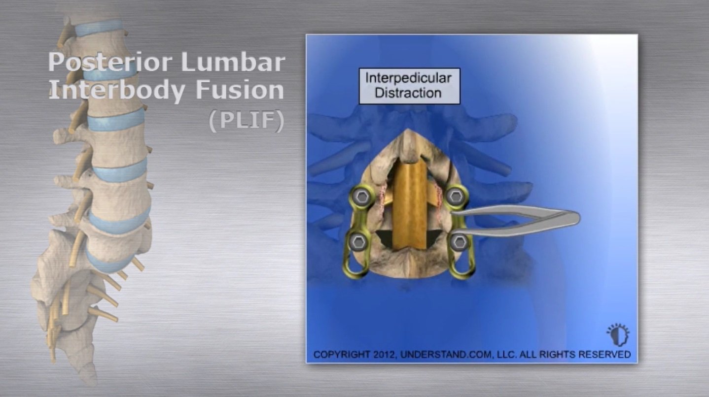 Informational Videos — reVive Spine Center