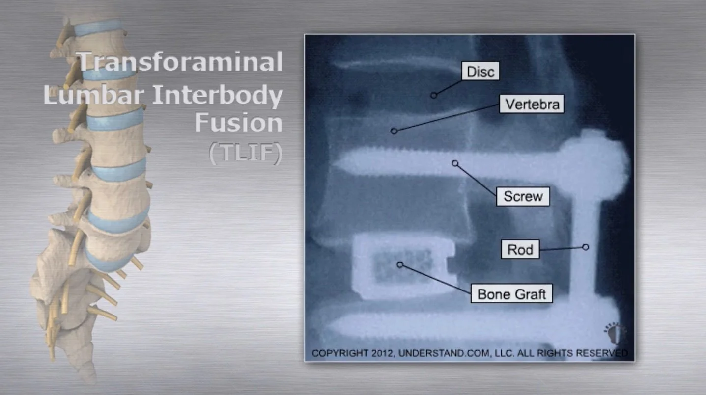Informational Videos — reVive Spine Center