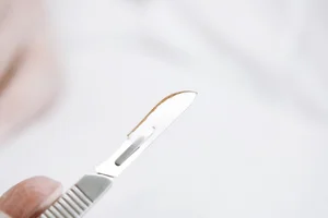 Dermaplaning Treatment Vancouver | Dermaplaning Facial Therapy