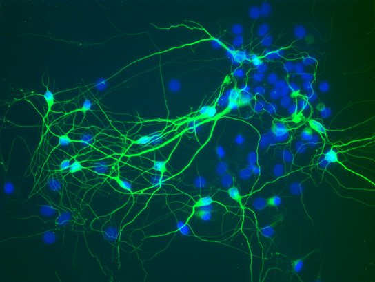 Mouse CD Cerebral Cortex — QBM Cell Science