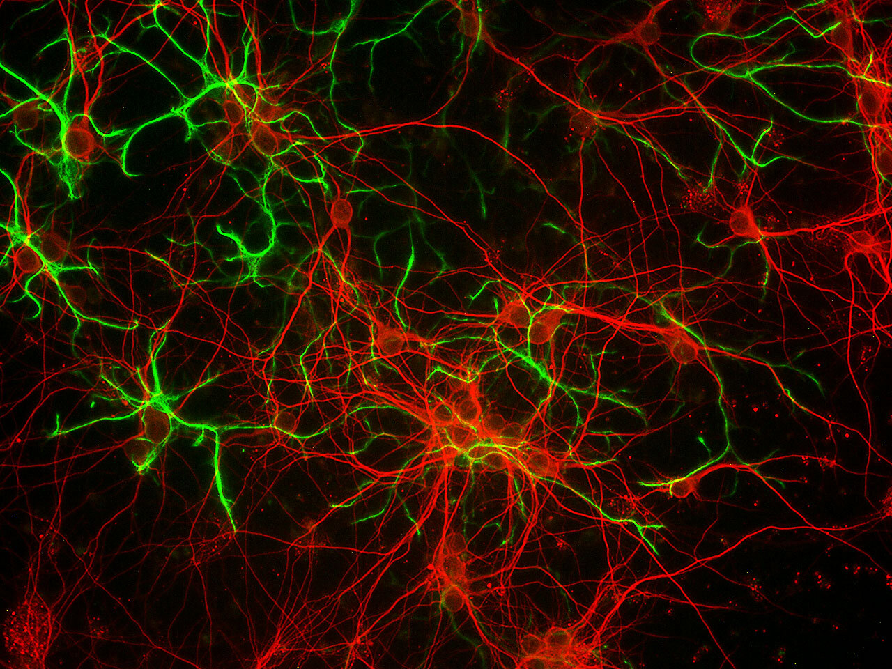Mouse CD Cerebral Cortex — QBM Cell Science