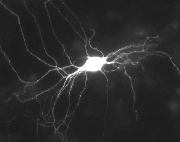 Photo Gallery — QBM Cell Science