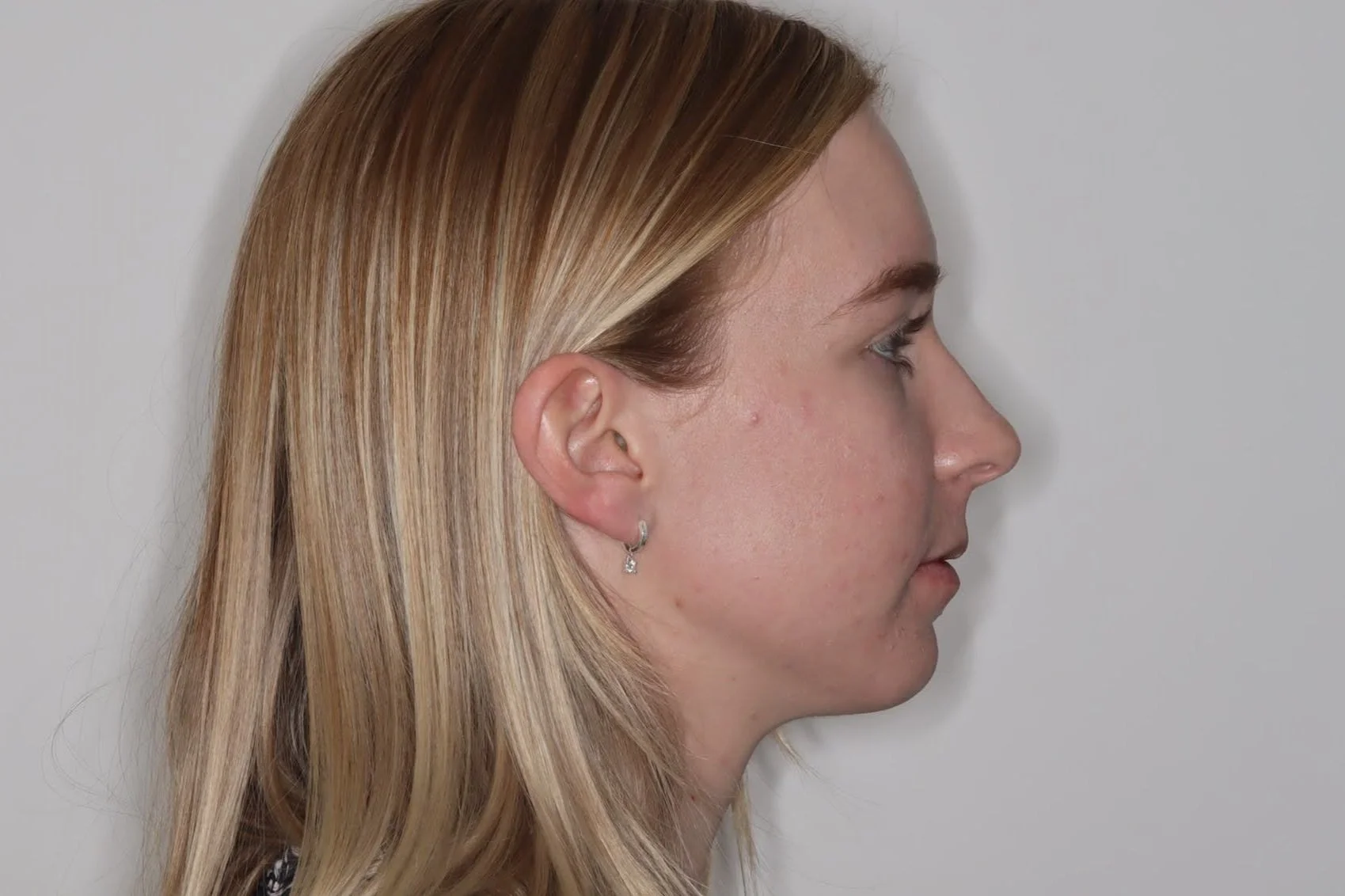 General 1 — Southern OMS