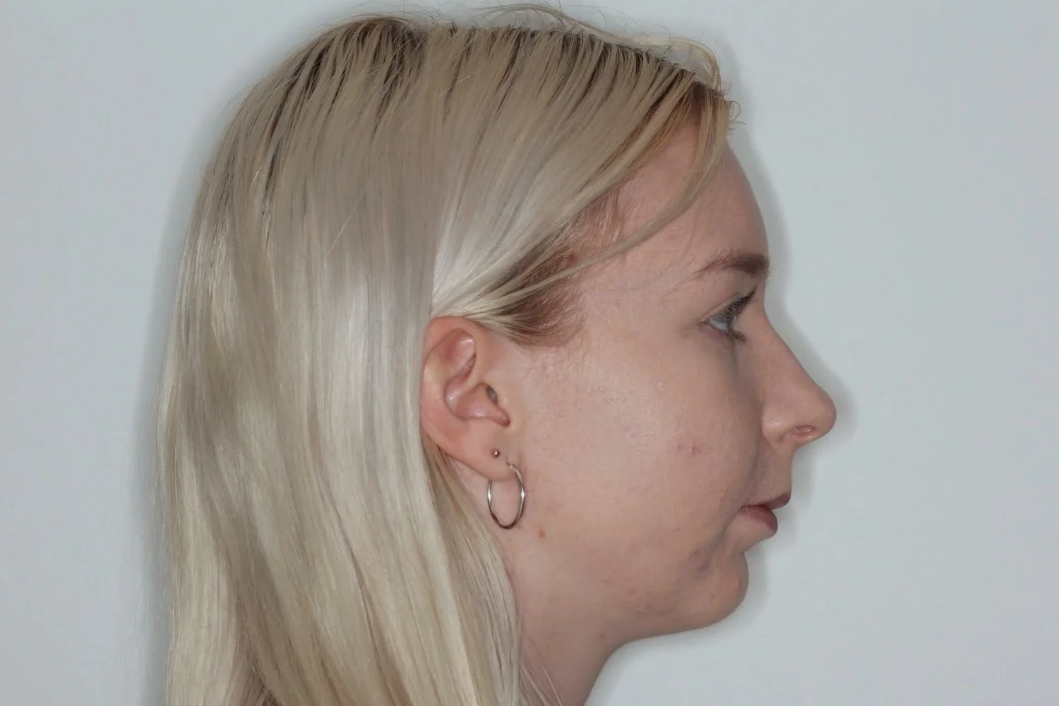 General 1 — Southern OMS