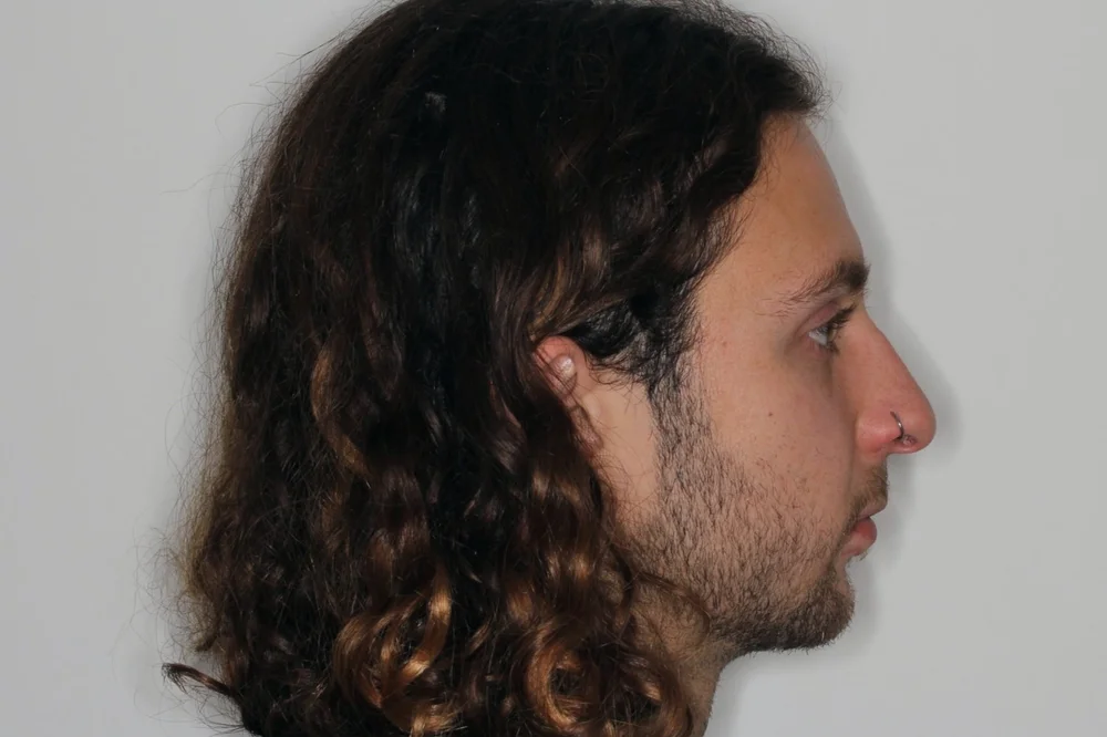 General 1 — Southern OMS