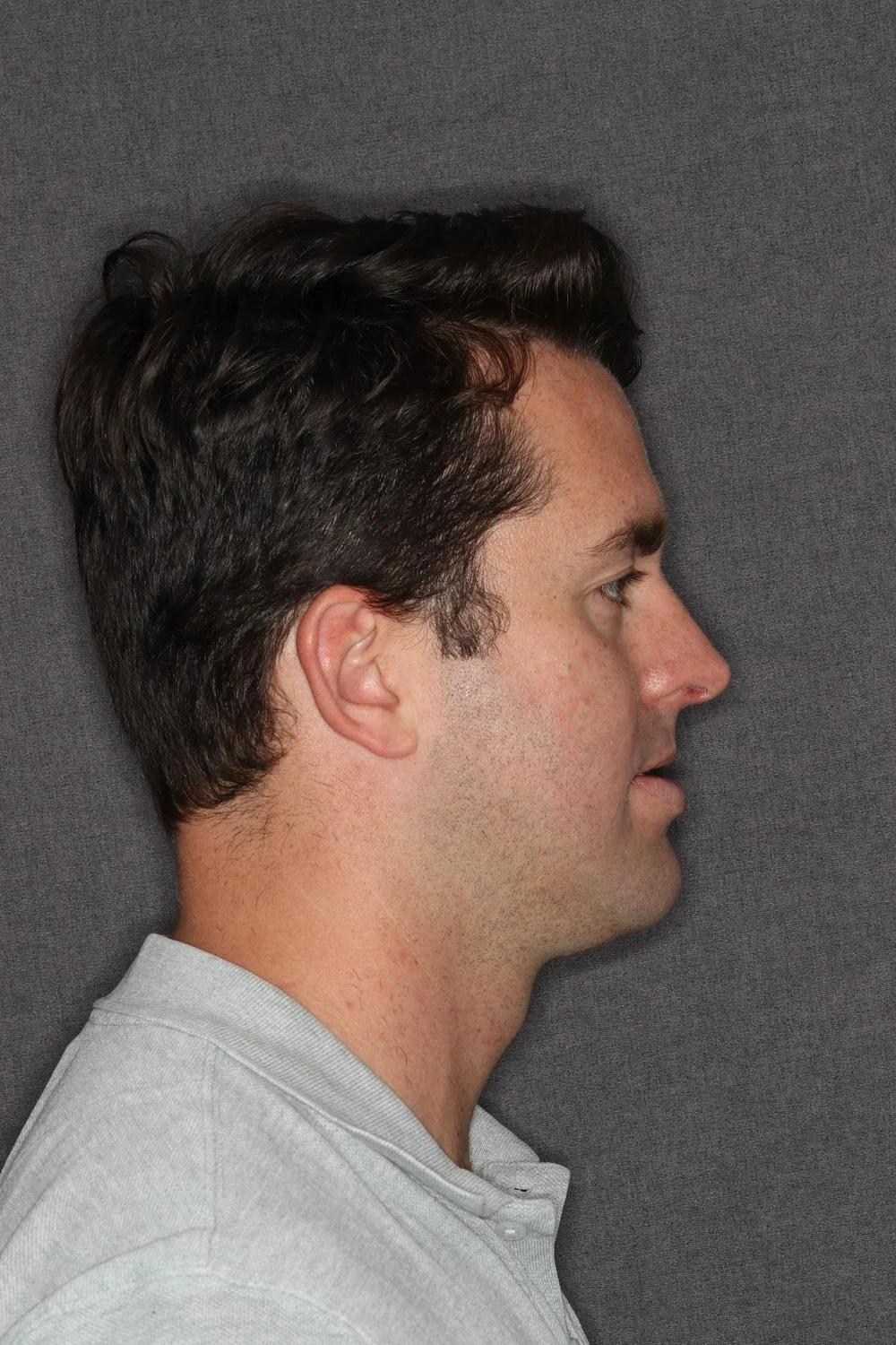 General 1 — Southern OMS