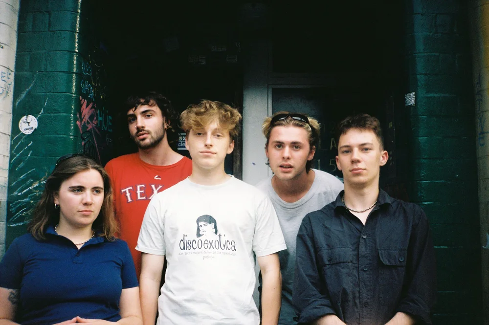Lip Filler: We sat down with one of Britain’s Buzziest Bands to discuss ...
