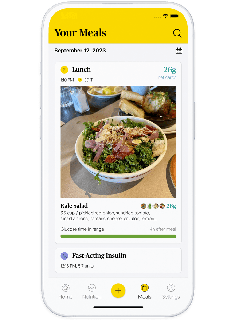 Dexcom CGM Connected Nutritional Analysis — RxFood