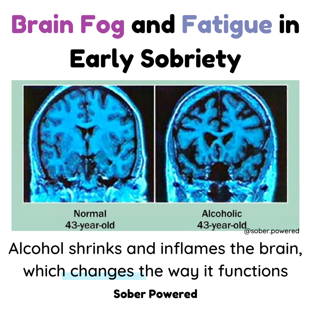 Brain Fog and Fatigue in Early Sobriety — Sober Powered
