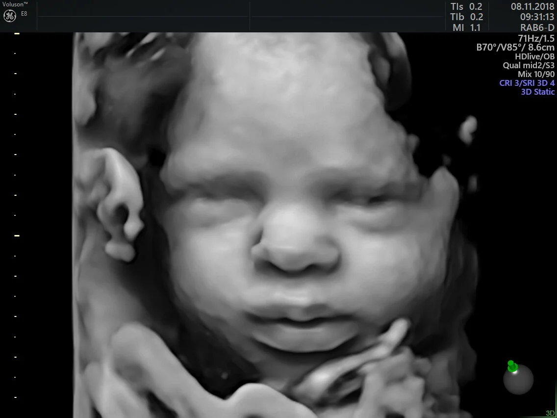 Galway Ultrasound Specialists