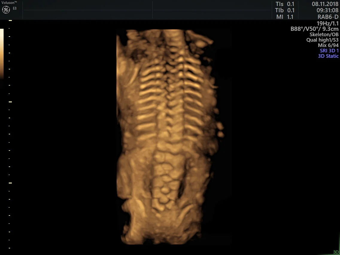 Pregnancy Scans — Galway Ultrasound Specialists