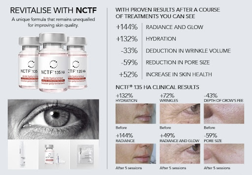 Chanel Injections Improve skin quality in the most delicate and thin ...