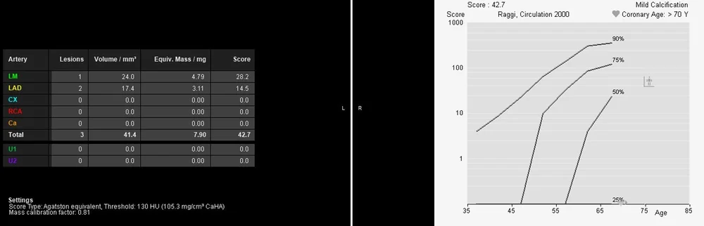 CT Scans with no long wait times serving Vancouver, Surrey, and the ...