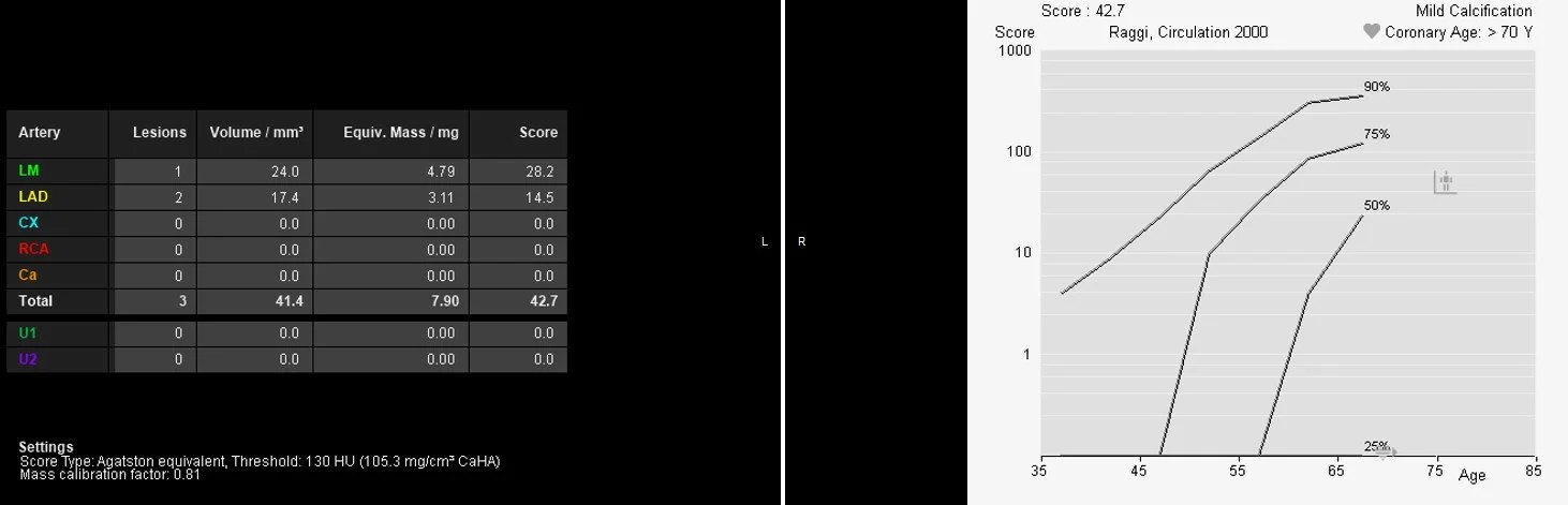 CT Scans with no long wait times serving Vancouver, Surrey, and the ...