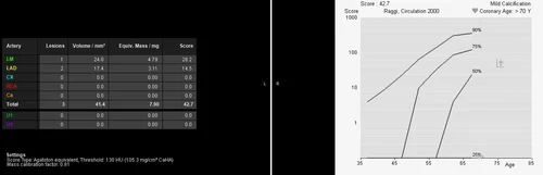 CT Scans with no long wait times serving Vancouver, Surrey, and the ...