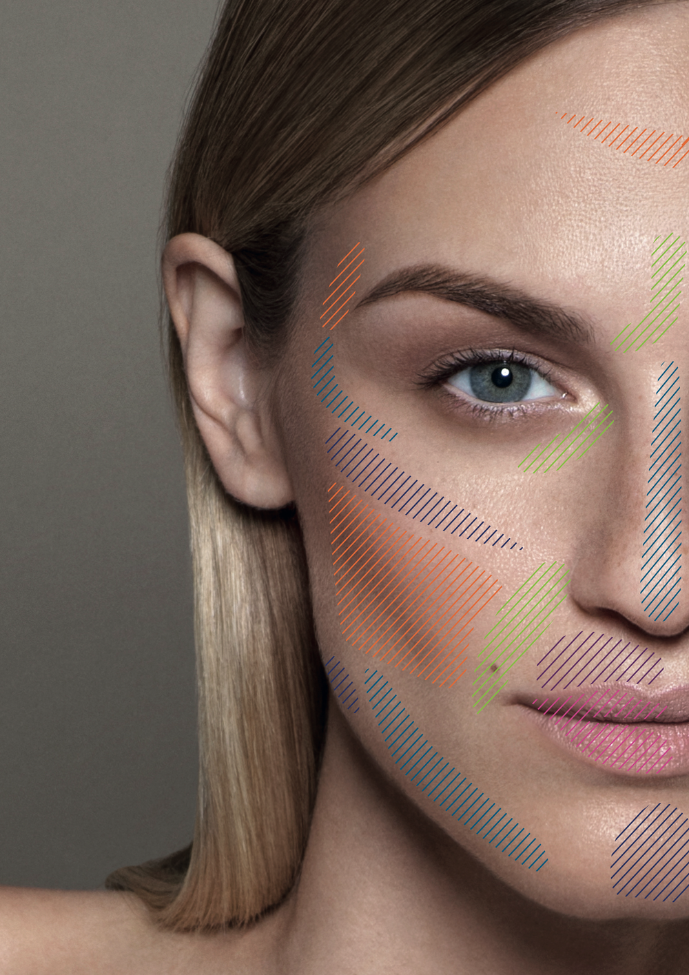 IBSA Injectables — Profhilo