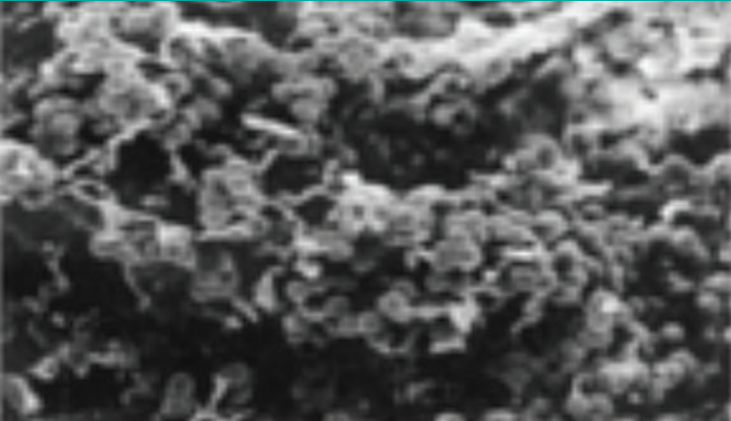 Science behind nailKALM® — nailKALM