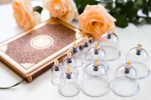Hijama Therapy in Ilford | Therapy Clinic London — Therapy Clinic London