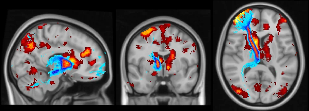XNAT — ImagingTools