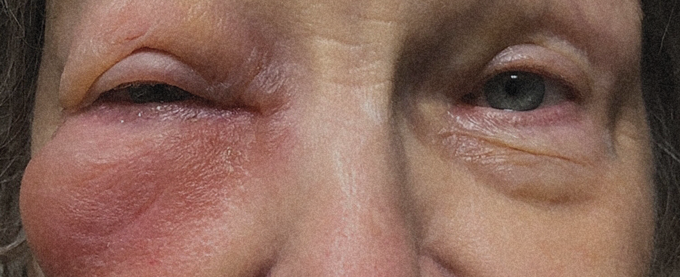 Ocular Emergencies Summit 2025 | Woo University