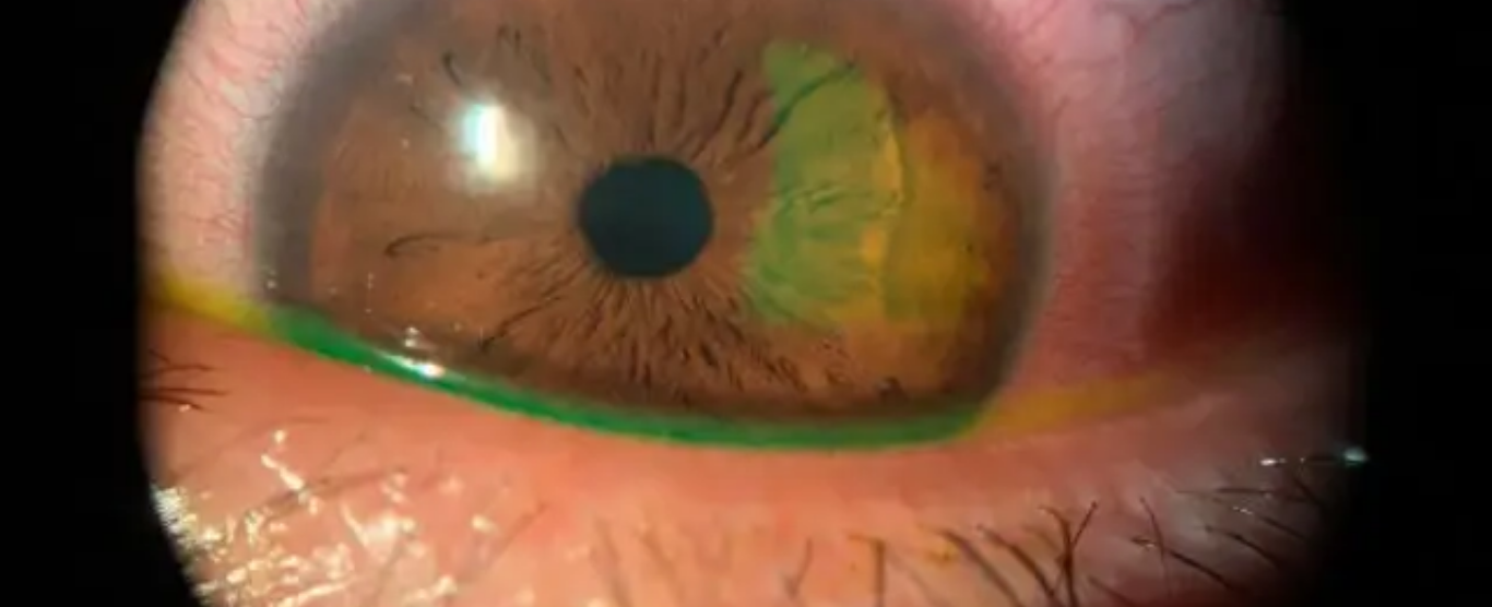 Ocular Emergencies Summit 2025 | Woo University